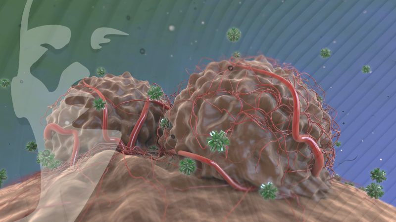 ¿QUÉ ES UN TUMOR? | Cirujano oncólogo en Ciudad Juárez